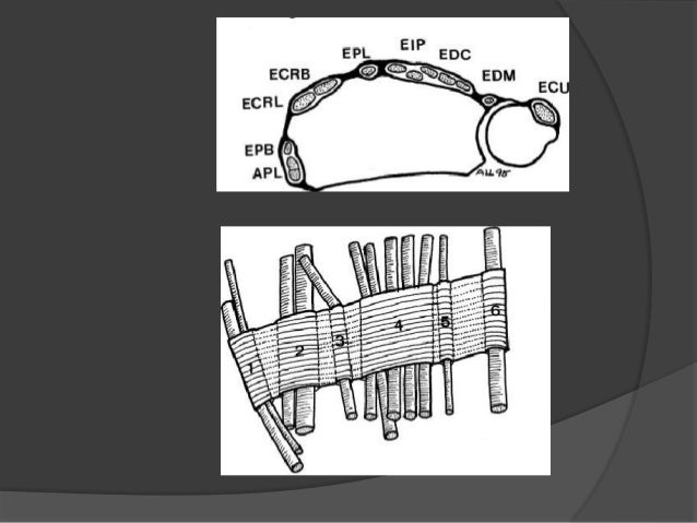 Extensor apparatus of hand injuries