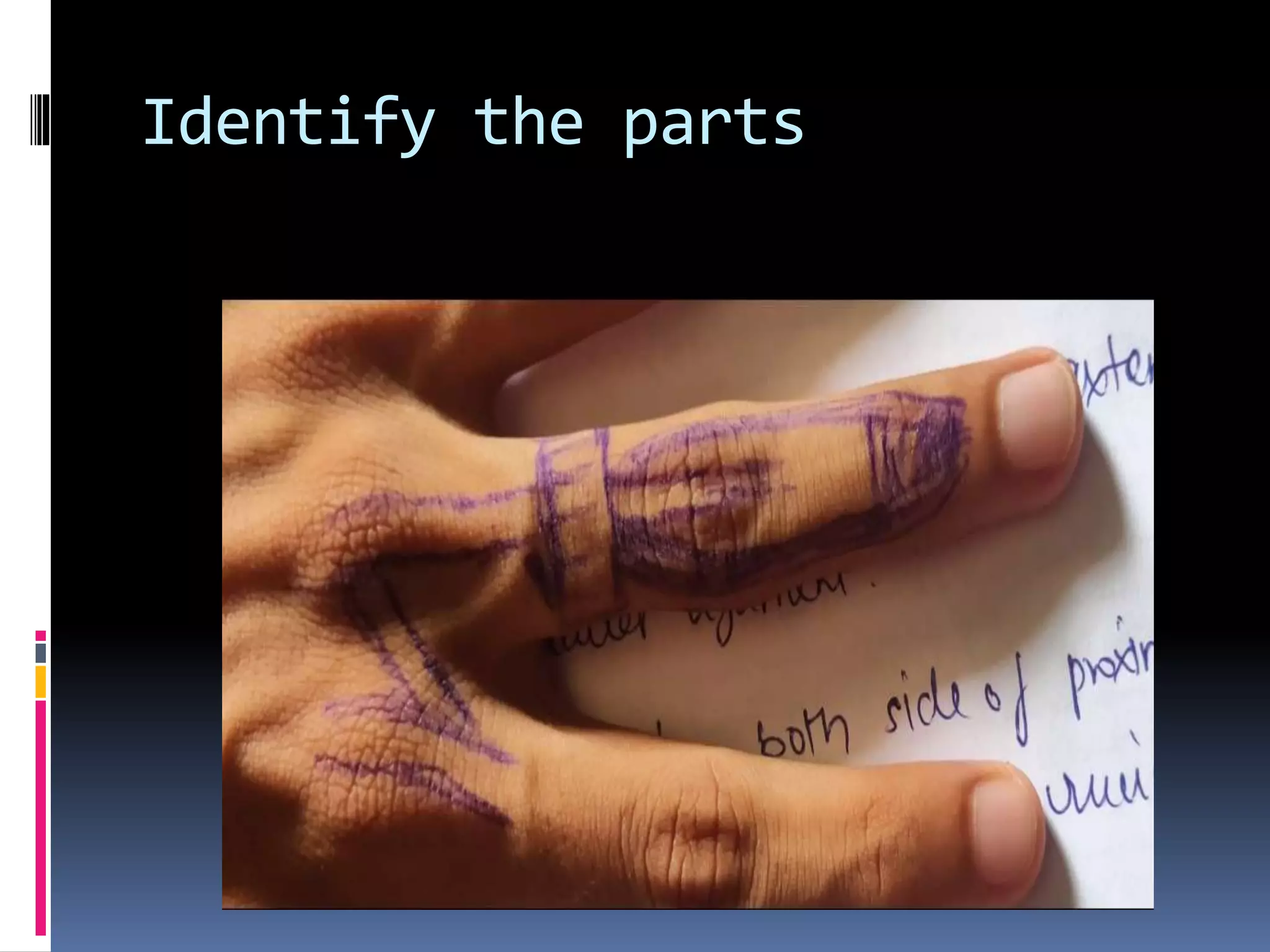 Extensor mechanism of finger | PPTX
