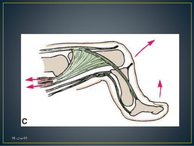 Extensor tendon injuries