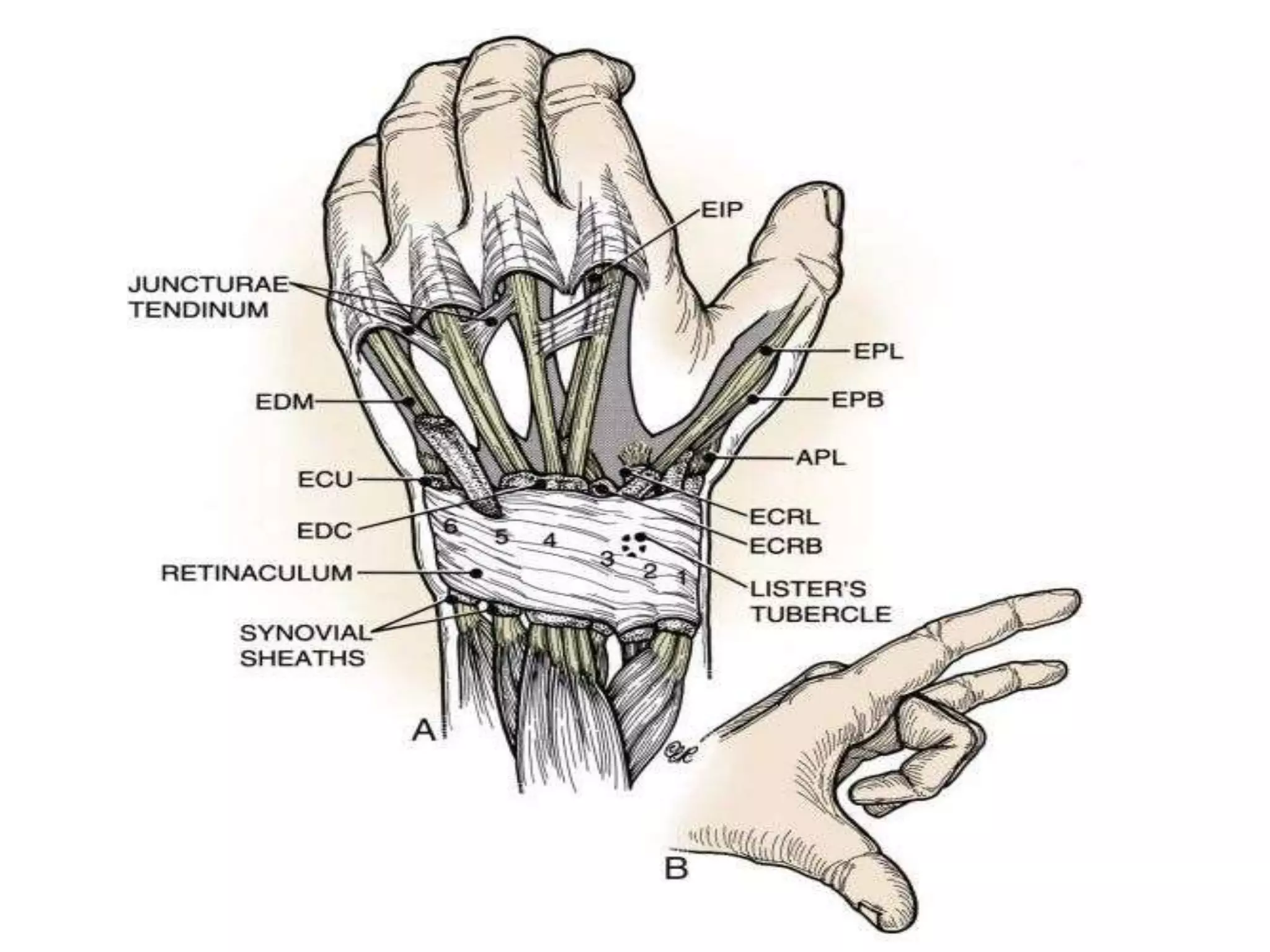 Extensor tendon injuries hand | PPTX