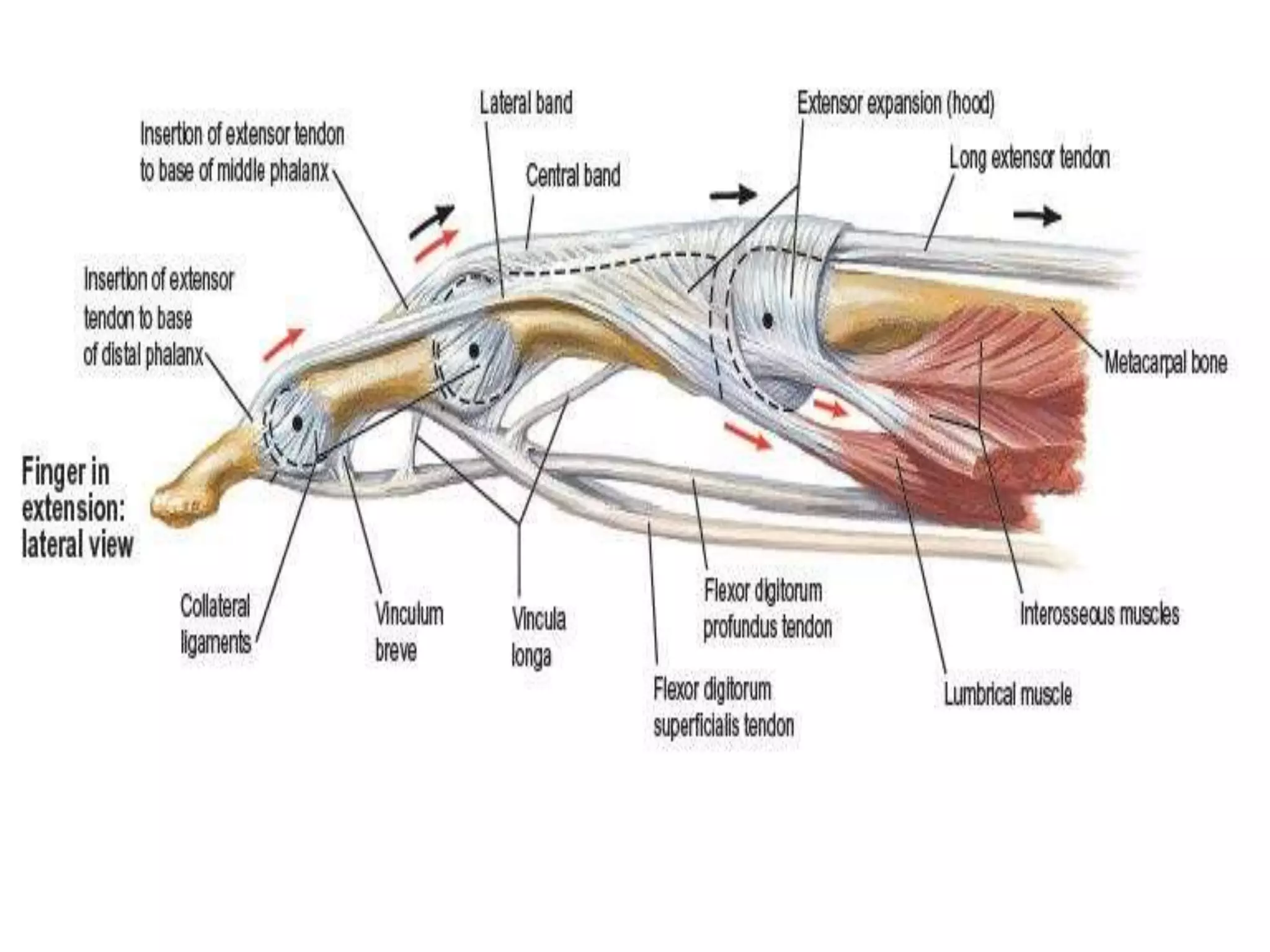 Extensor tendon injuries hand | PPTX | Death, Injury, or Military ...