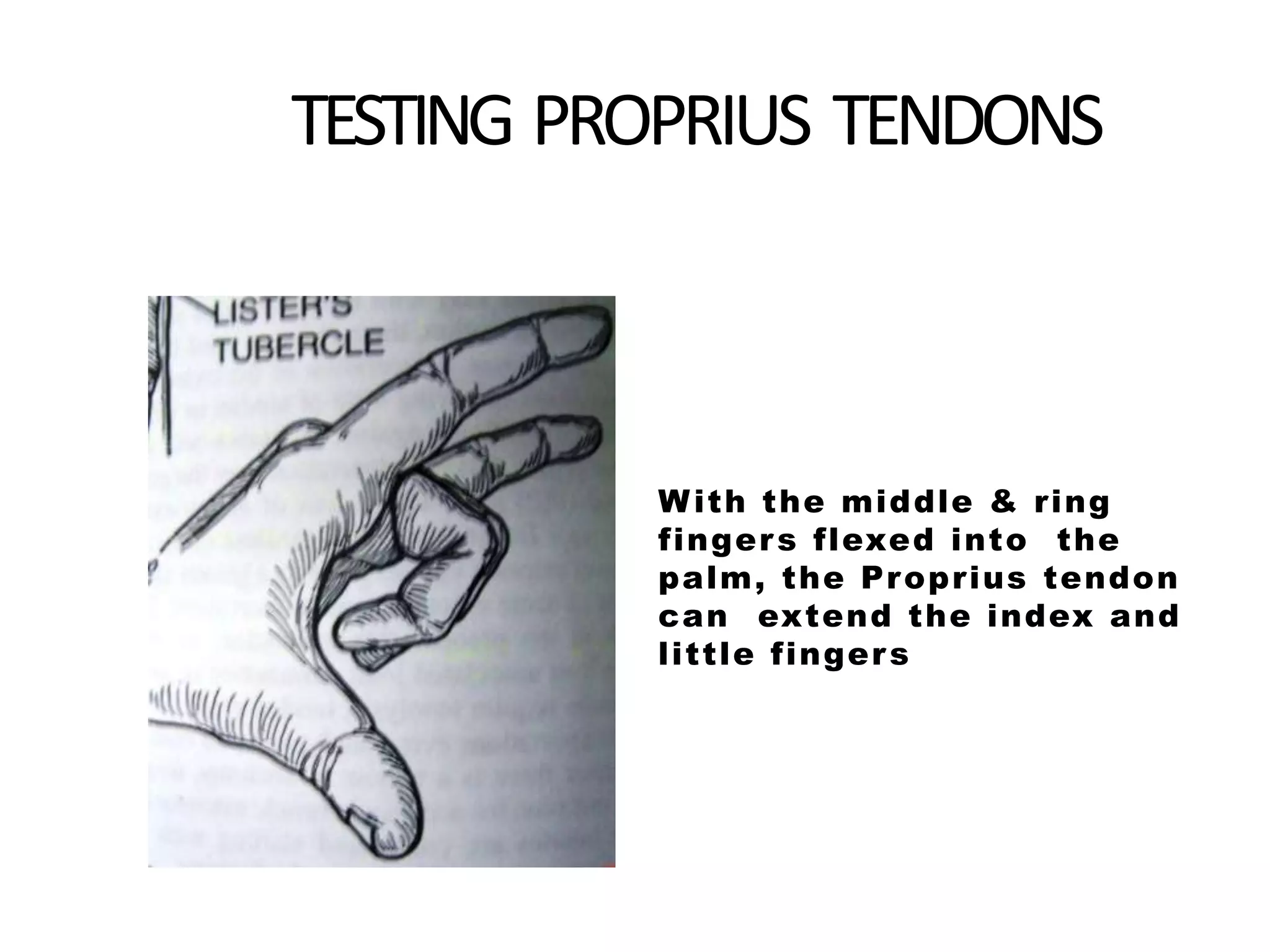 Extensor tendon injuries hand | PPTX