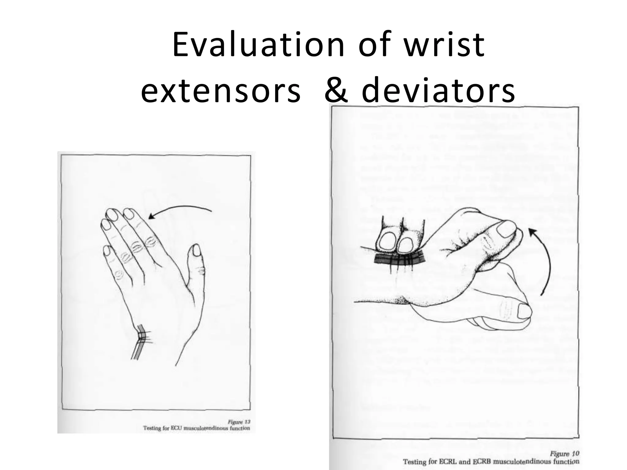 Extensor tendon injuries hand | PPTX | Death, Injury, or Military ...
