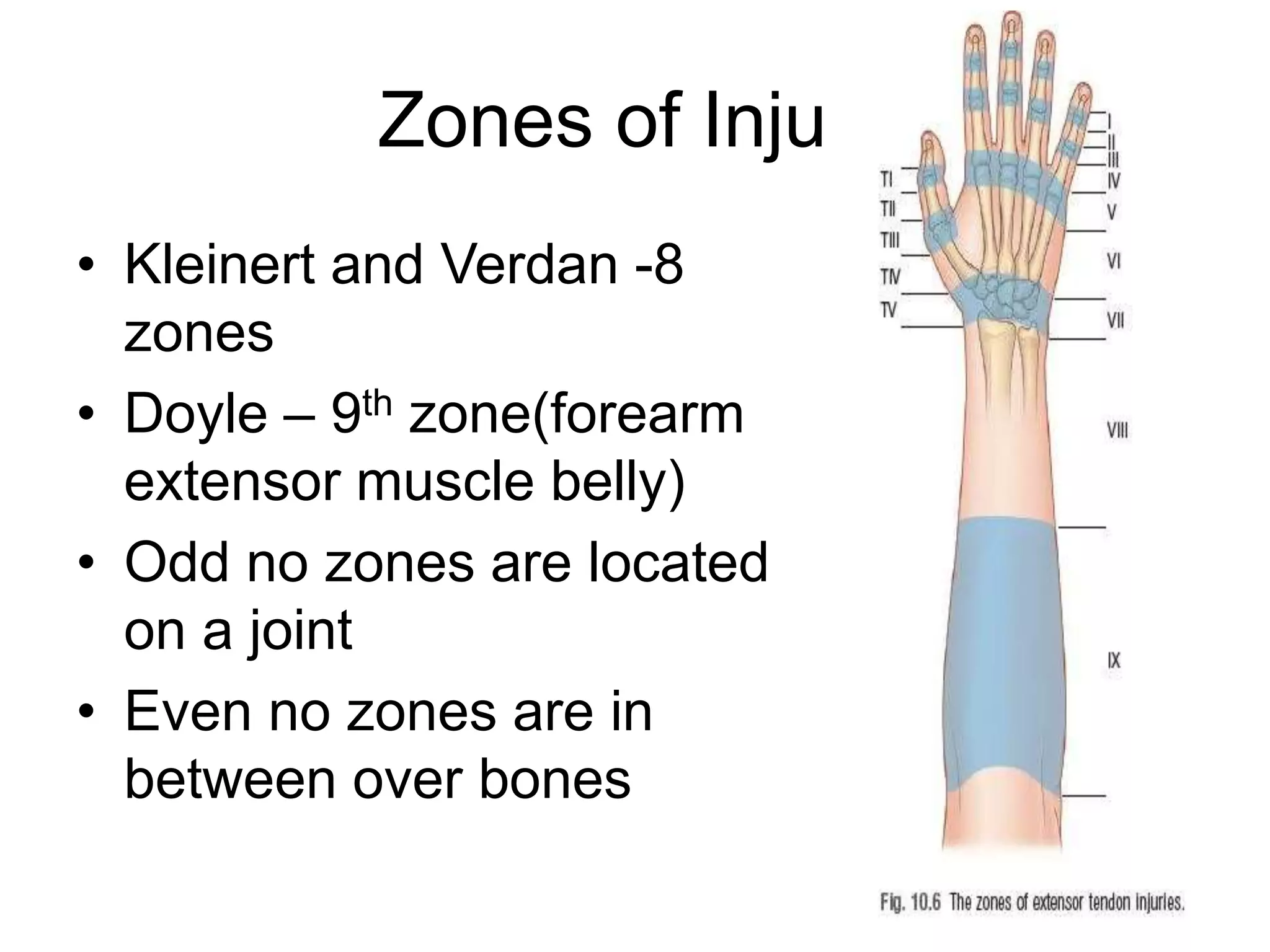 Extensor tendon injuries hand | PPTX
