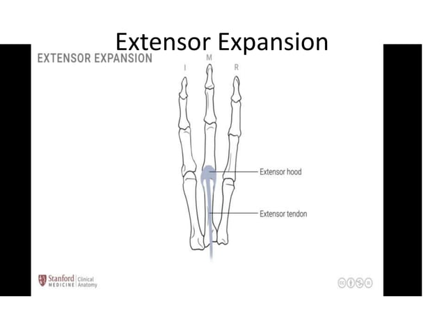 Extensor tendon injuries hand | PPTX | Death, Injury, or Military ...
