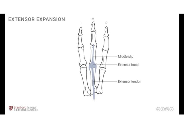 Extensor tendon injuries hand | PPTX | Death, Injury, or Military ...
