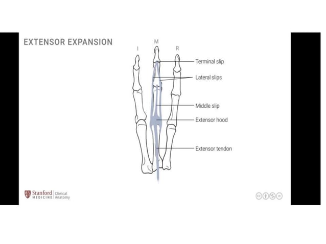 Extensor tendon injuries hand | PPTX | Death, Injury, or Military ...