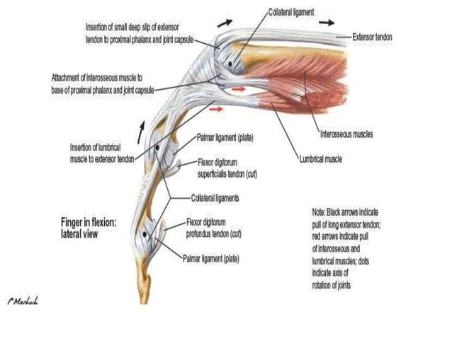 Extensor tendon injuries hand | PPTX | Death, Injury, or Military ...
