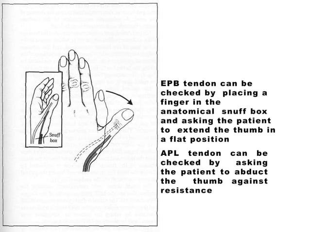 Extensor tendon injuries hand | PPTX | Death, Injury, or Military ...
