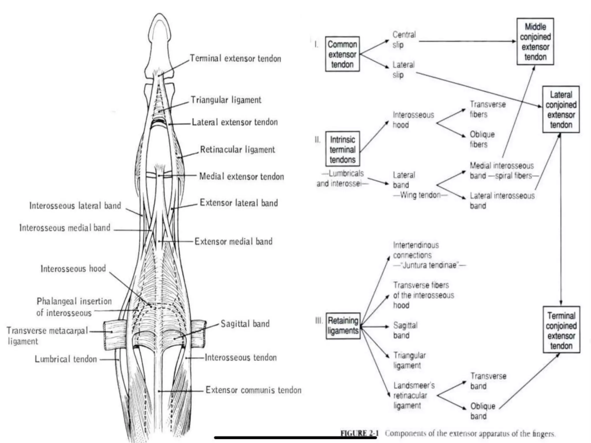 Extensor Tendon Injuries Pptx