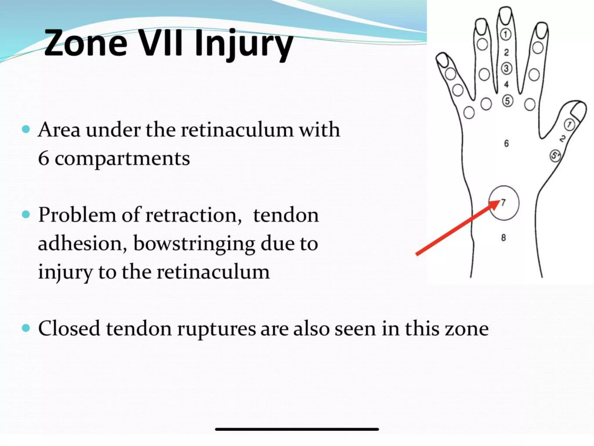 Extensor tendon injuries | PPTX