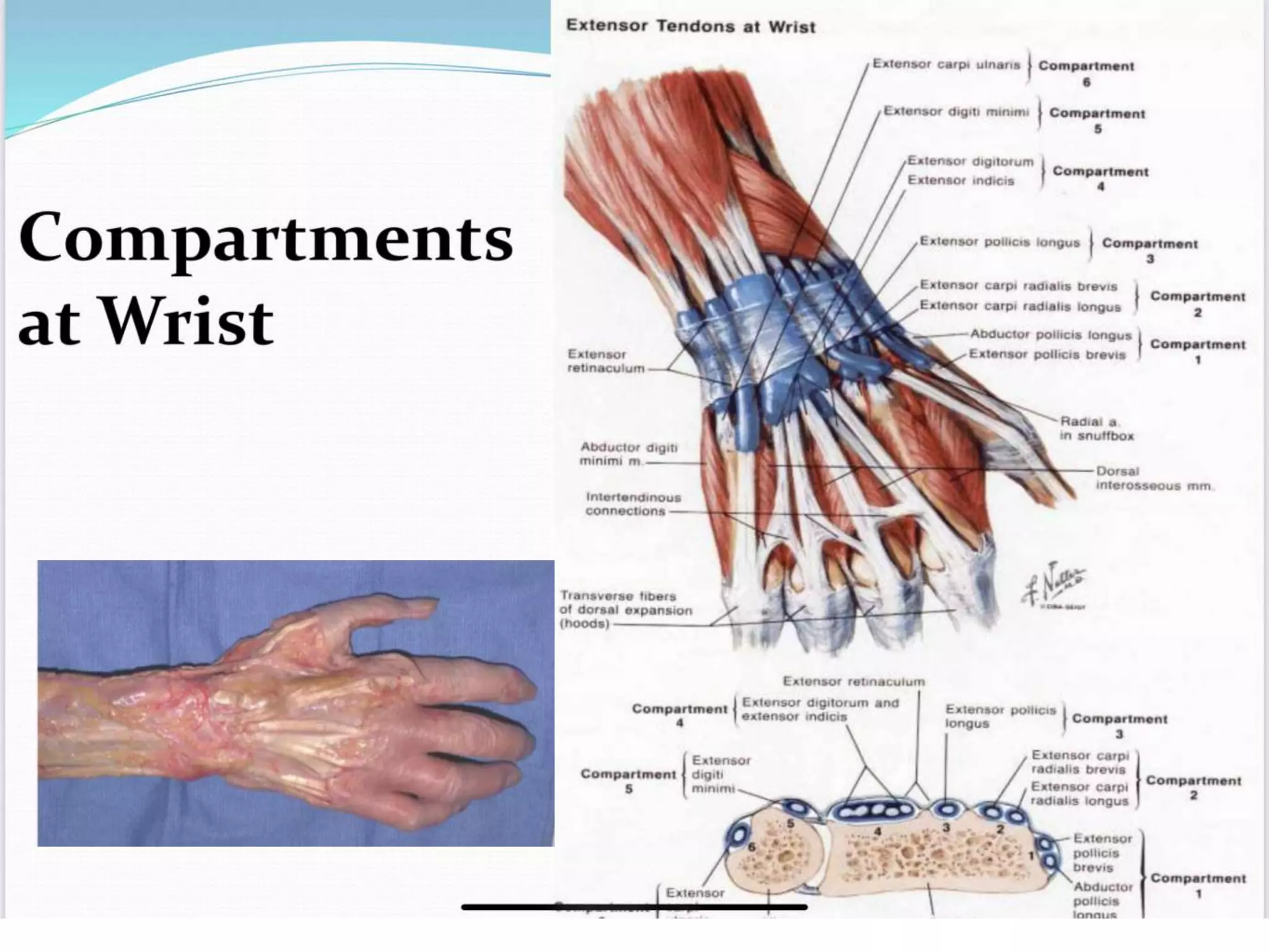 Extensor tendon injuries | PPTX