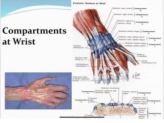 Extensor tendon injuries | PPT