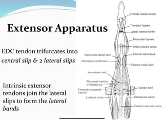 Extensor tendon injuries | PPTX