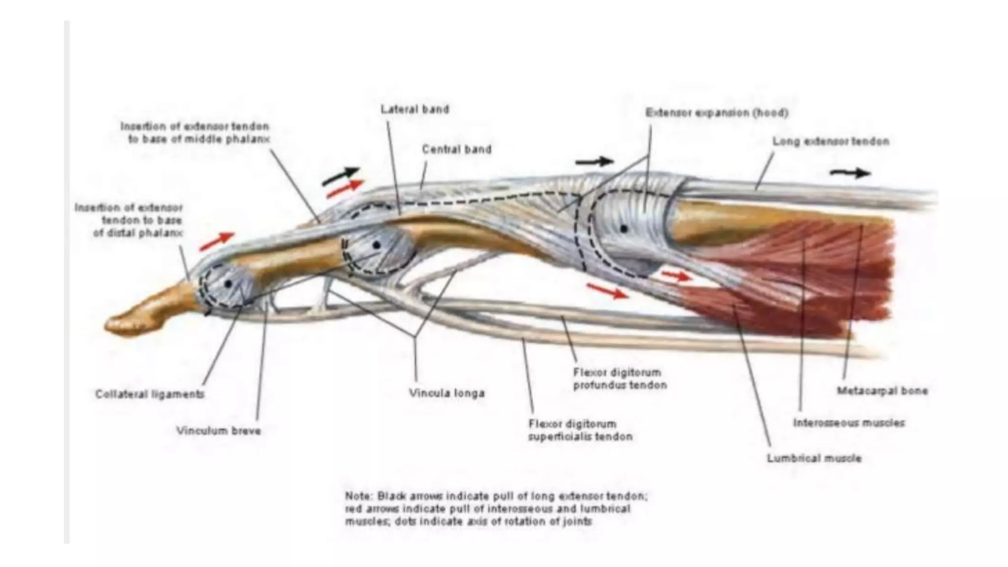 Extensor tendon injury | PPTX