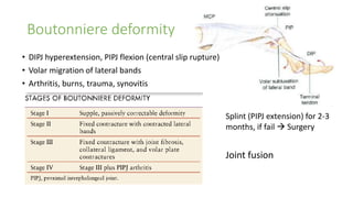 Extensor tendon injury | PPTX