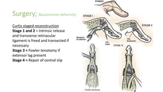 Extensor tendon injury | PPTX