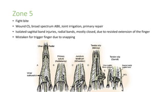 Extensor tendon injury | PPTX