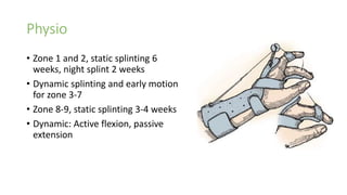 Extensor tendon injury | PPTX | Death, Injury, or Military Conflict ...