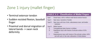 Extensor tendon injury | PPTX