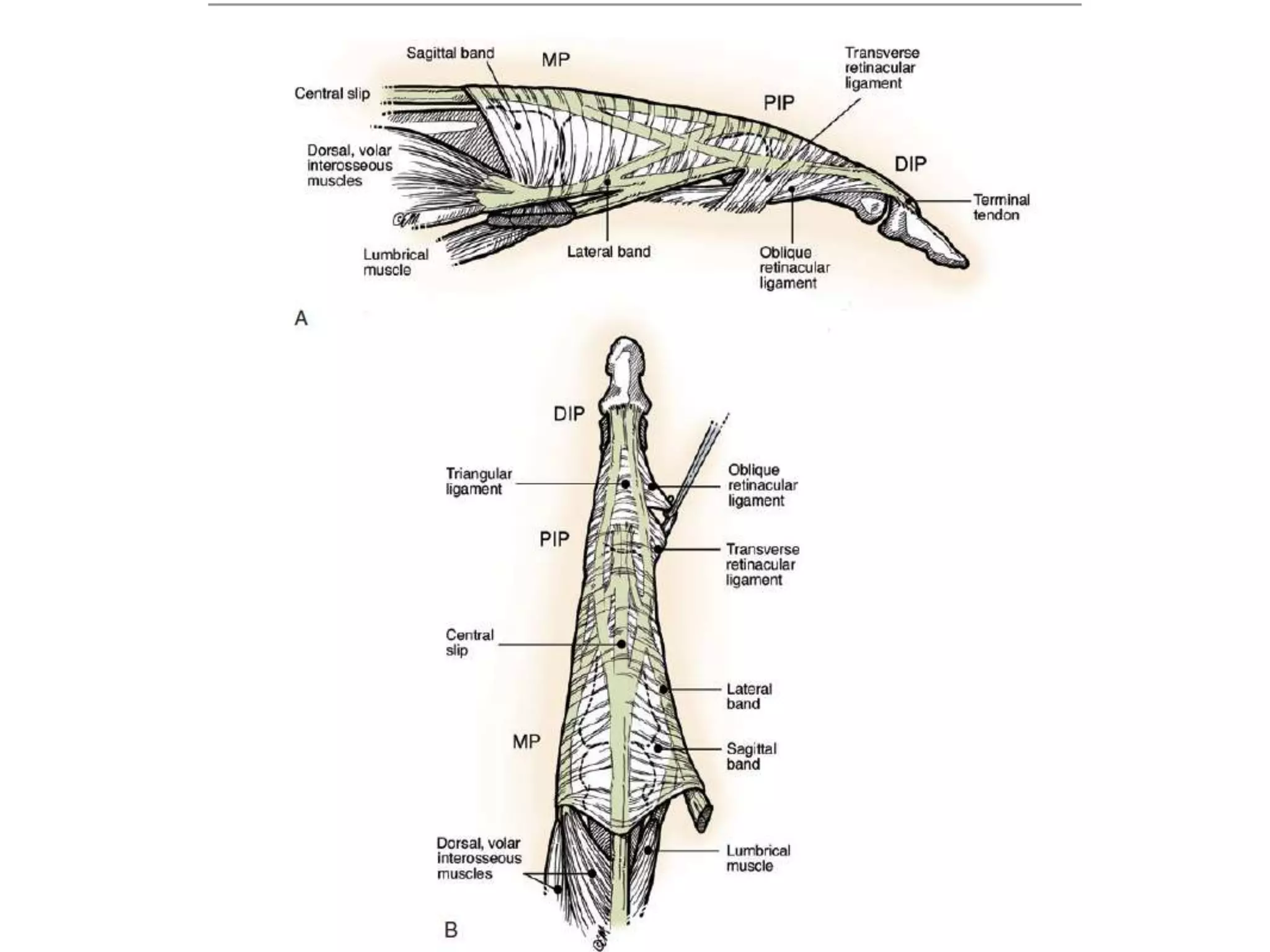 Extensor tendon injury | PPTX | Death, Injury, or Military Conflict ...
