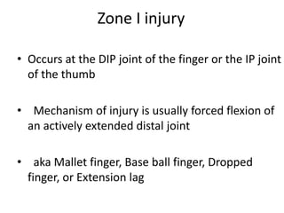 Extensor tendon injury | PPTX