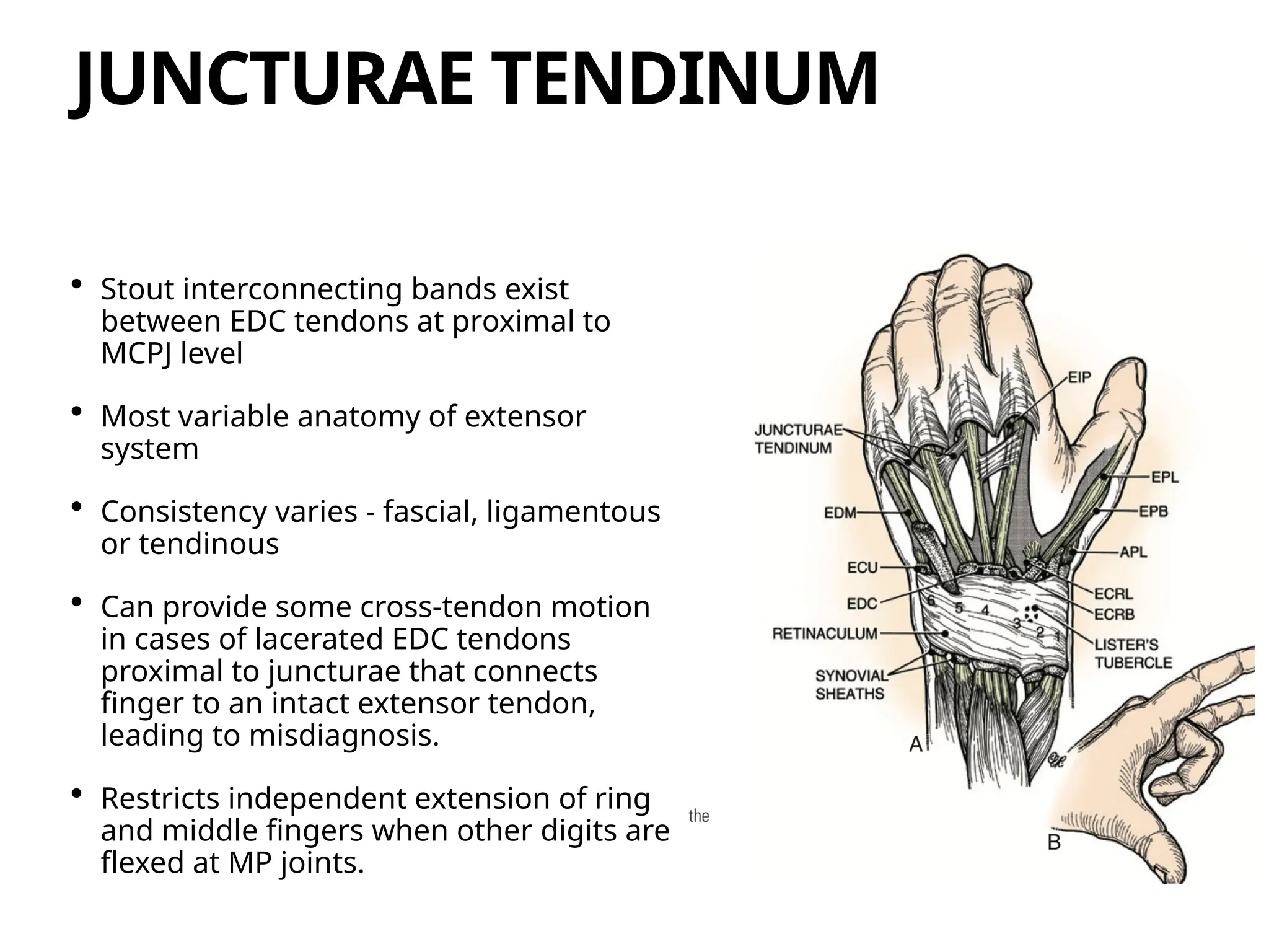 Extensor tendon anatomy, injury and its mangement pptx | PPTX