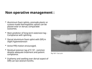 Extensor tendon anatomy, injury and its mangement pptx | PPTX