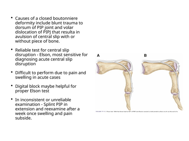 Extensor tendon anatomy, injury and its mangement pptx | PPTX | Death ...