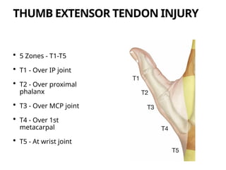 Extensor tendon anatomy, injury and its mangement pptx | PPTX