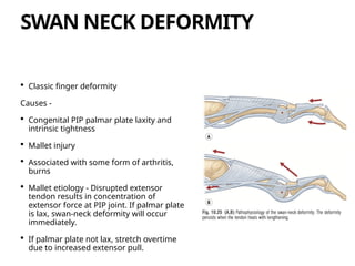 Extensor tendon anatomy, injury and its mangement pptx | PPTX
