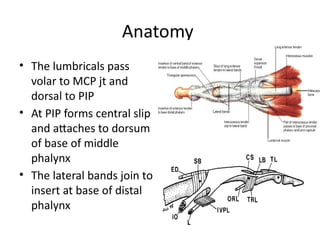management of extensor tendon injury.pptx