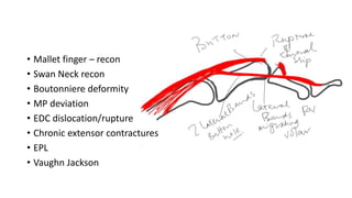 Extensor Tendon Lecture for OT 2022 no audio.pptx