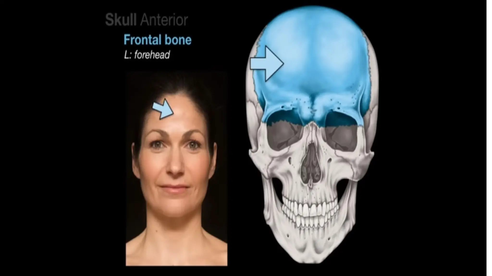 exterior of skull (skull views anterior posterior and lateral) | PPTX