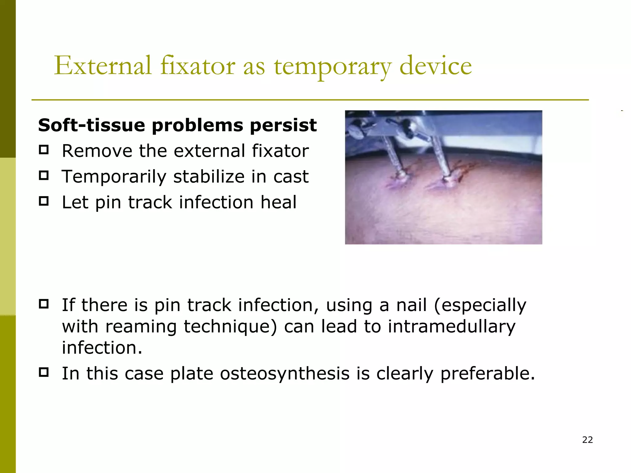 External fixator | PPT
