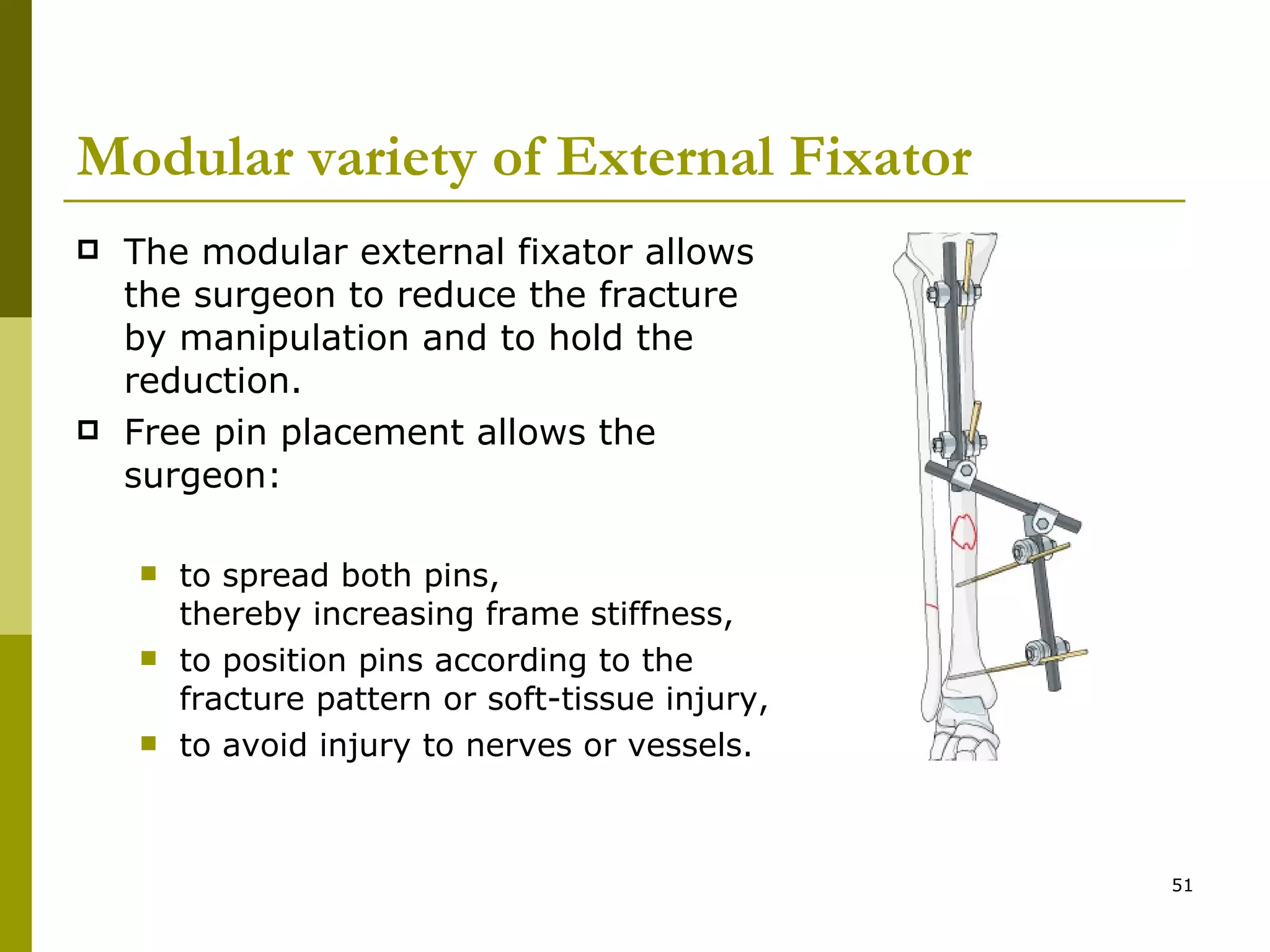 External fixator | PPT