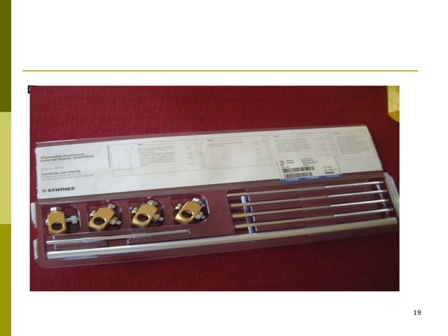 External fixator | PPT