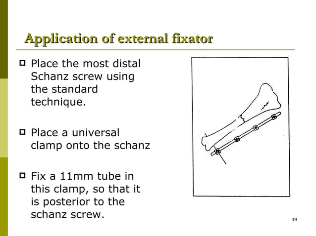 External fixator | PPT