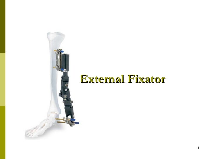 External fixator