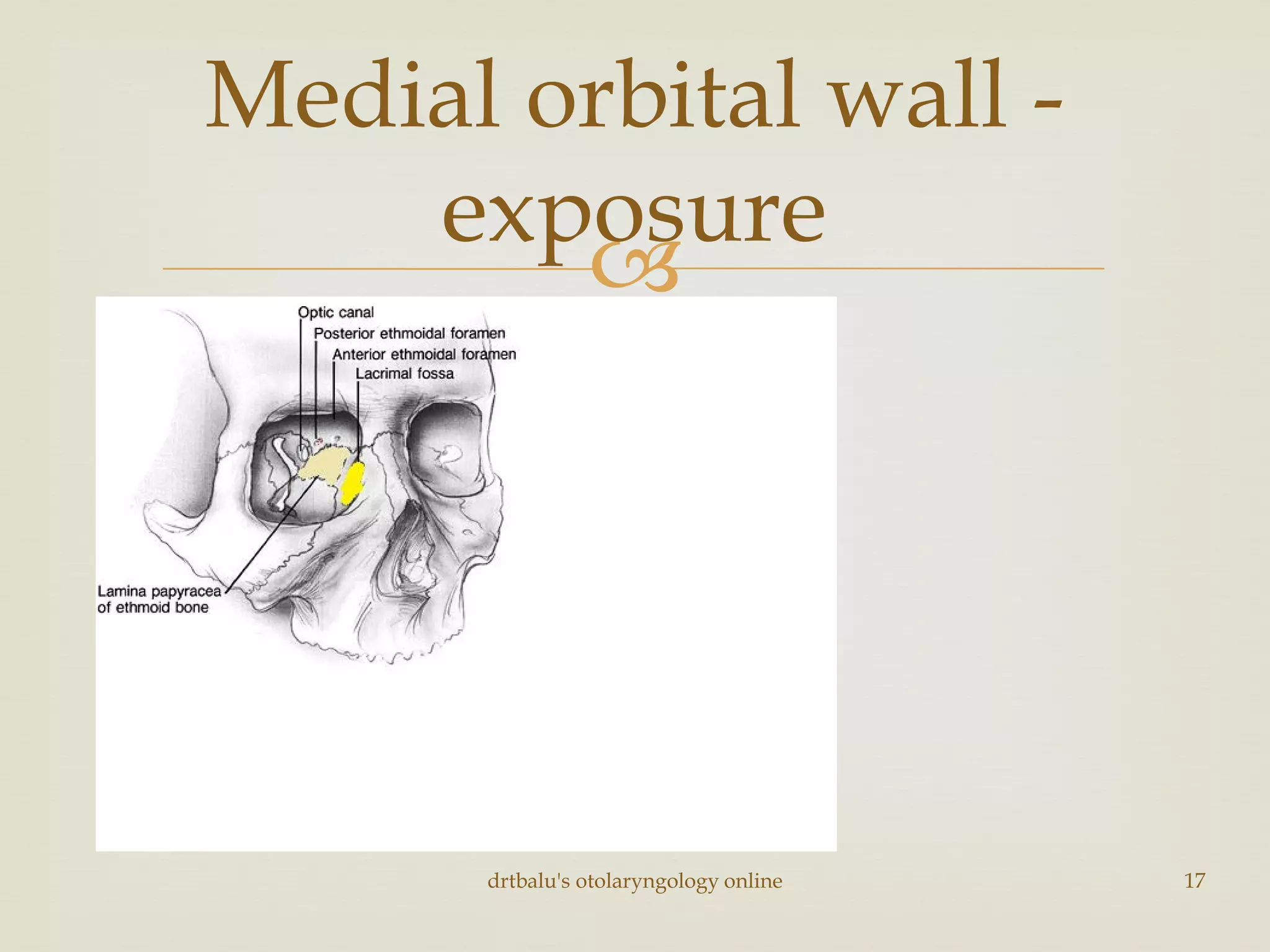 External approaches to sinus surgery | PDF