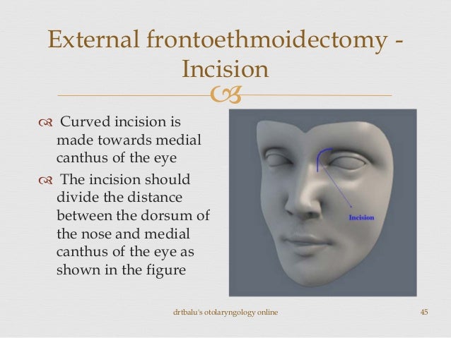 External approaches to sinus surgery