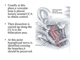 External carotid artery, branches and ligation | PPTX