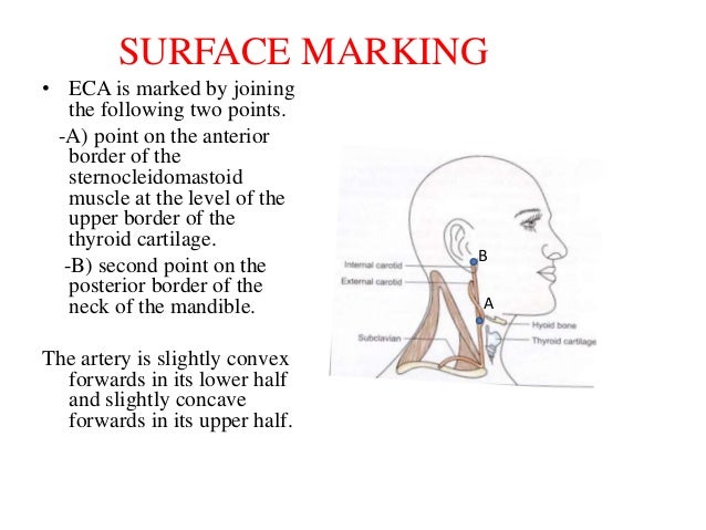 External carotid artery, branches and ligation
