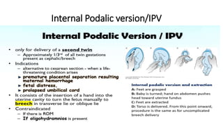 External_cephalic_version_and_Internal_podalic_version_for_Anst.ppt