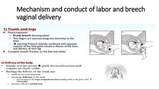 External_cephalic_version_and_Internal_podalic_version_for_Anst.ppt