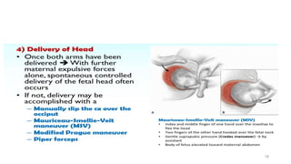 External_cephalic_version_and_Internal_podalic_version_for_Anst.ppt
