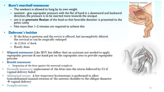 External_cephalic_version_and_Internal_podalic_version_for_Anst.ppt
