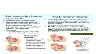 External_cephalic_version_and_Internal_podalic_version_for_Anst.ppt