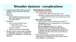 External_cephalic_version_and_Internal_podalic_version_for_Anst.ppt