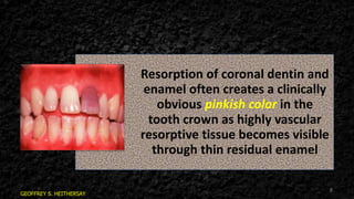 “Saving the borders” External cervical resorption : A Case report | PPT